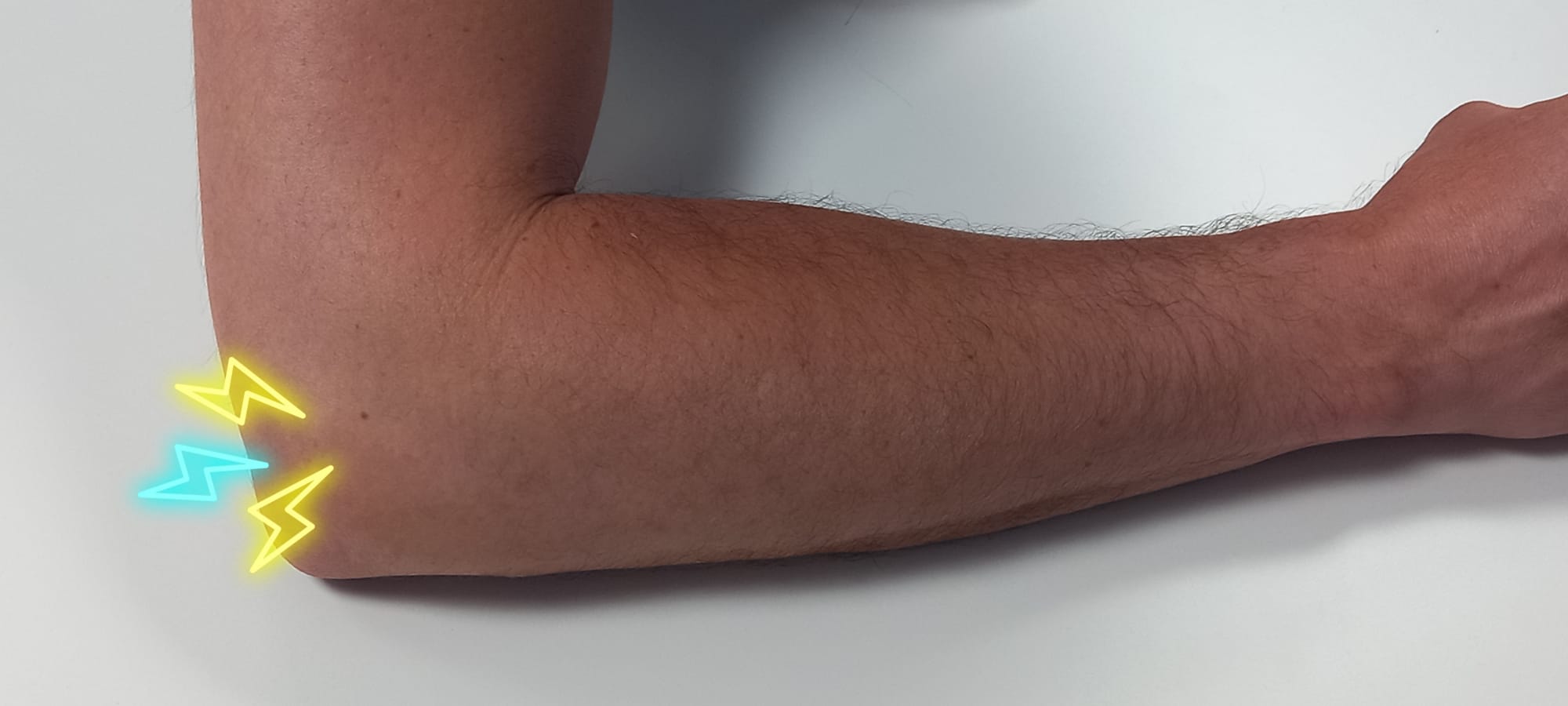 EPICONDILITIS O “CODO DE TENISTA” | Blog Dr. David Pescador